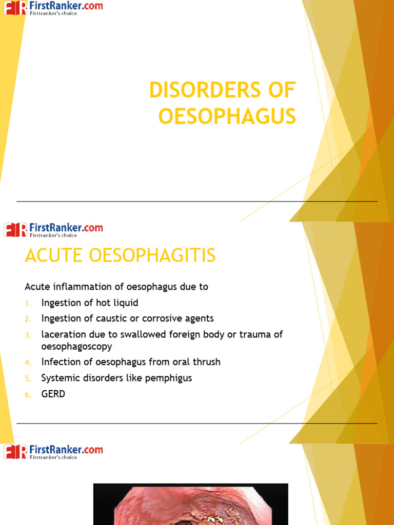 Oesophagus | PDF