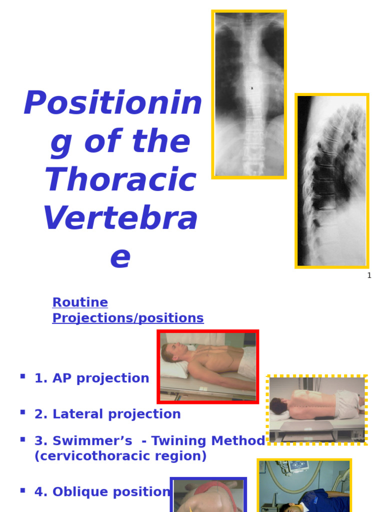 Positioning of the Thoracic Spine Moodle | PDF