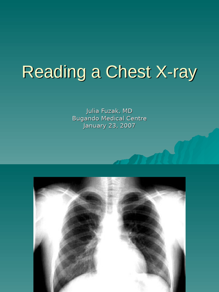 Reading A Pediatric Chest Xray | PDF
