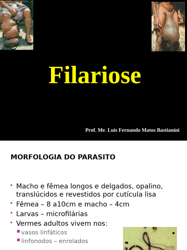 Filariose | PDF