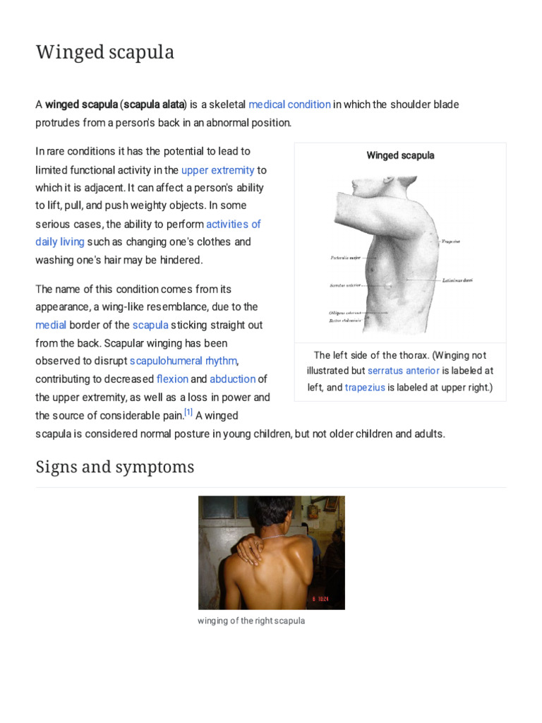 Winged scapula - Wikipedia | PDF