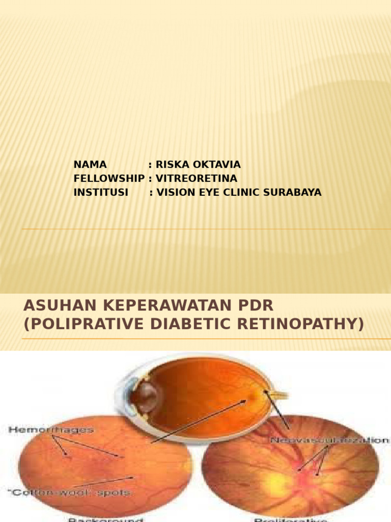 Presentation Retina RISKA FIX | PDF