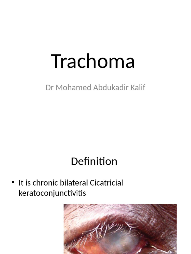 Trachoma | PDF
