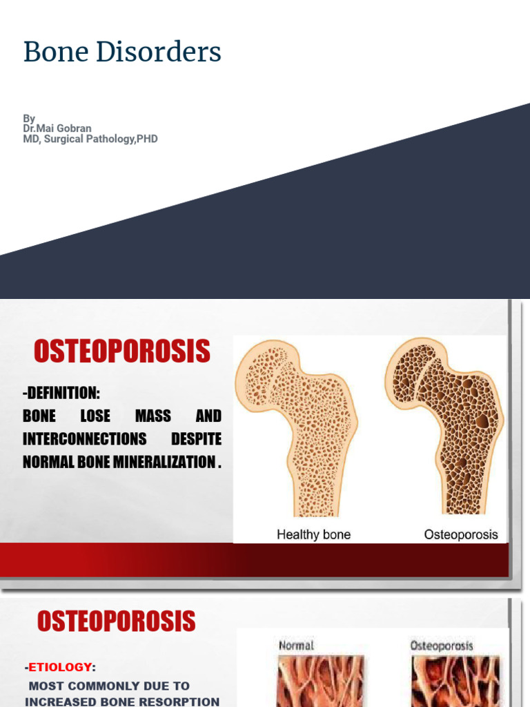 Bone Disorders and Tumors | PDF