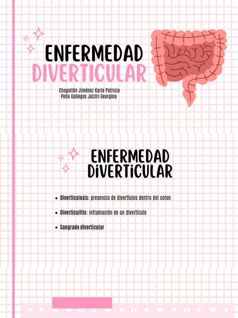 Enfermedad Diverticular | PDF