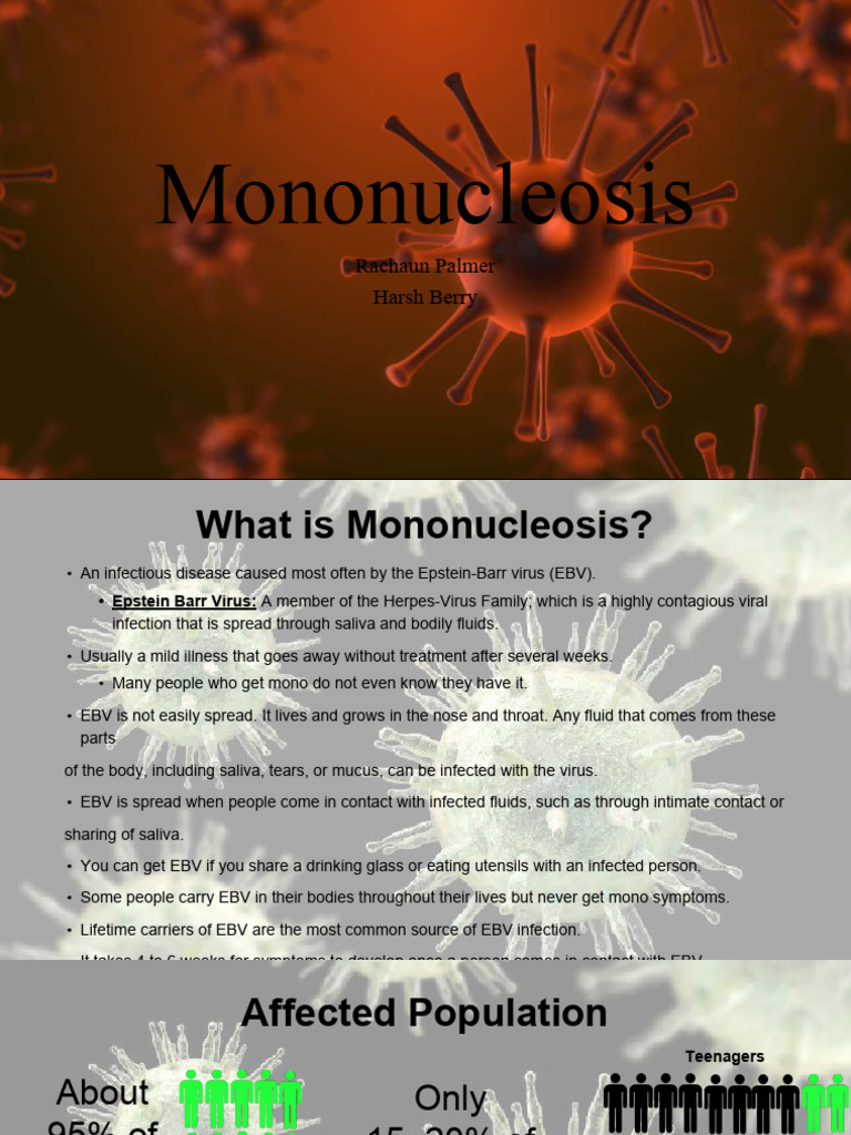 Mononucleosis Incomplete Presentation by Rauchan | PDF