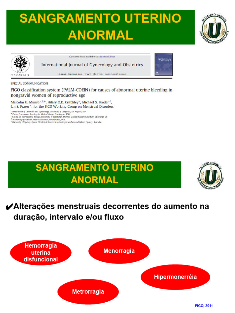 Sangramento Uterino Anormal | PDF