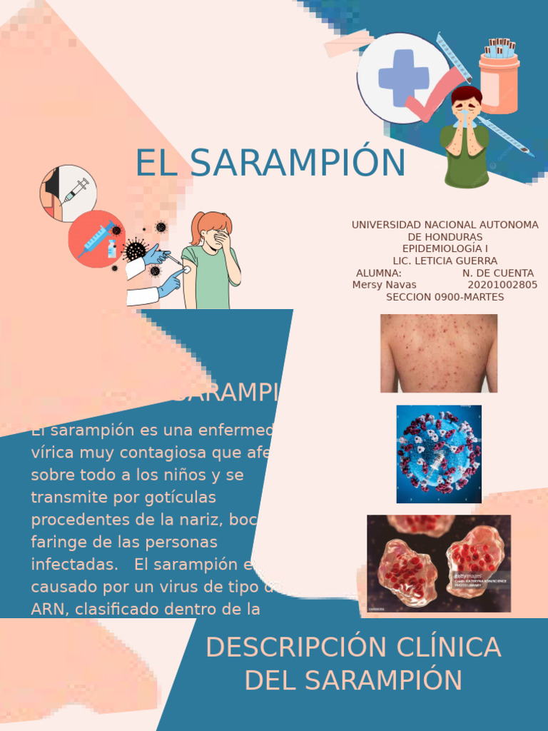 El Sarampión | PDF