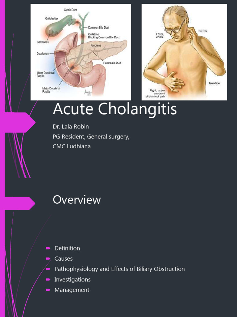 Cholangitis | PDF