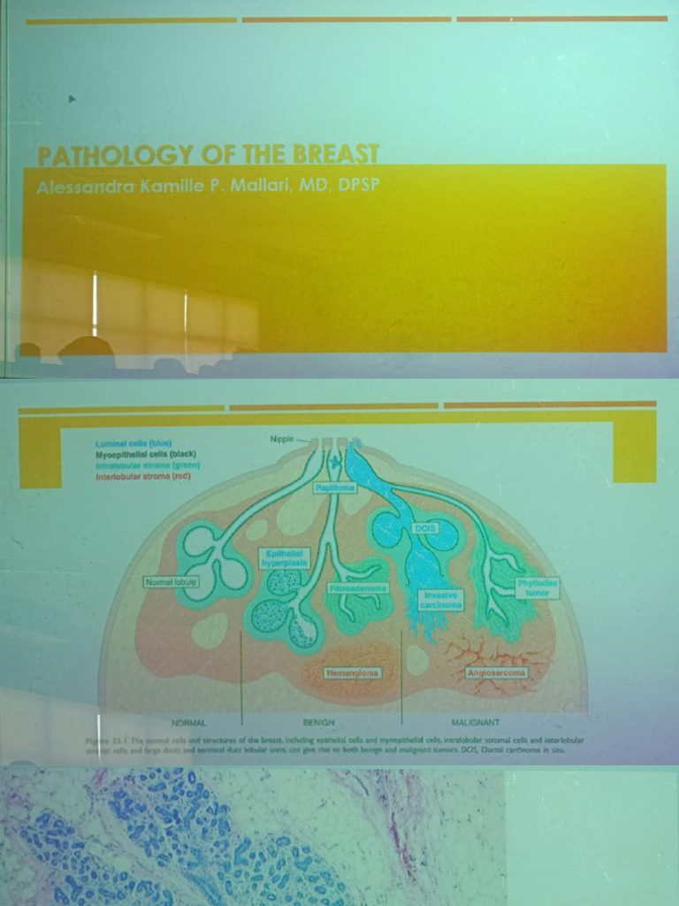 21.2 FGT - Breast | PDF