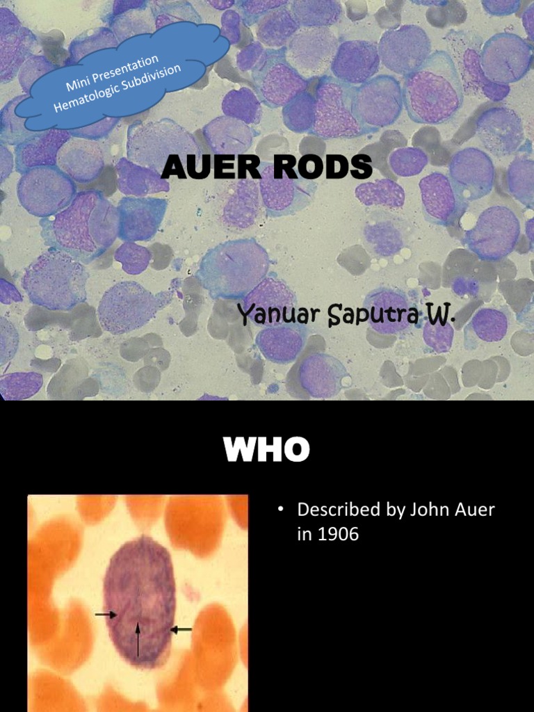 Auer Rods | PDF