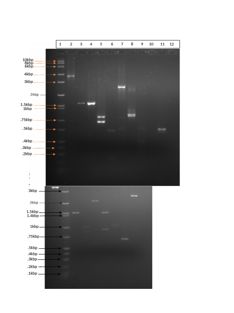 Gel Electrophoresis Labelled | PDF