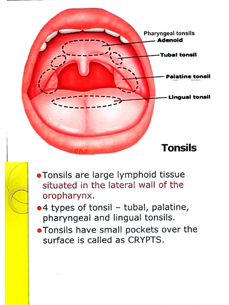 Tonsilitis | PDF