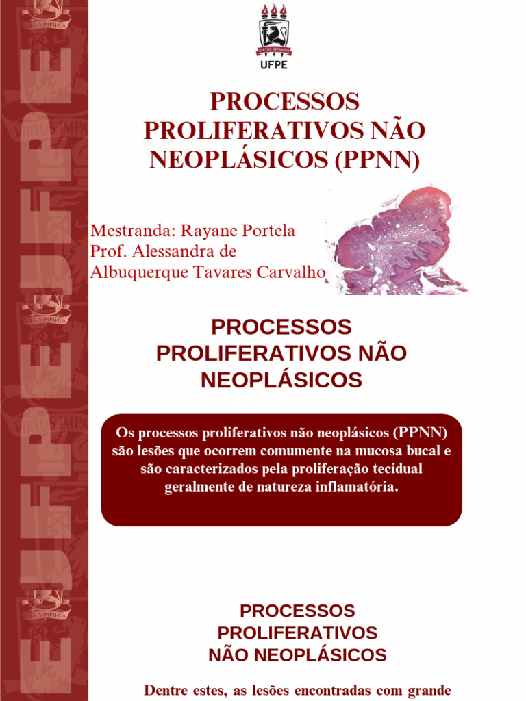 Aula PPNN | PDF