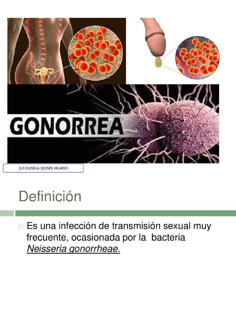 Gonorrea 14 (1) | PDF