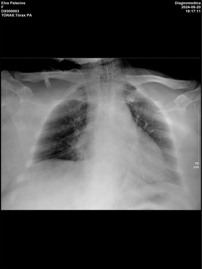 Elva Palacios.. | PDF