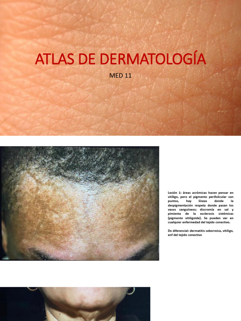 Atlas de Dermatología | PDF