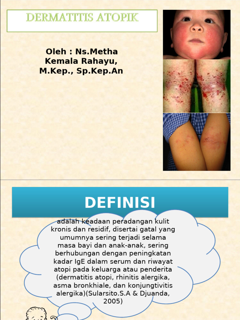 Dermatitis Atopik | PDF