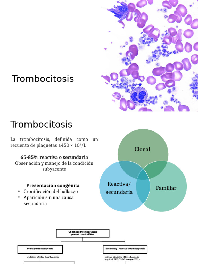 TROMBOCITOSIS | PDF