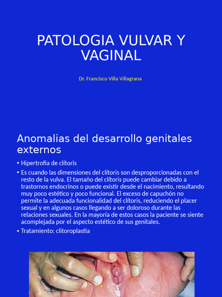 Patologia Vulvar y Vaginal | PDF