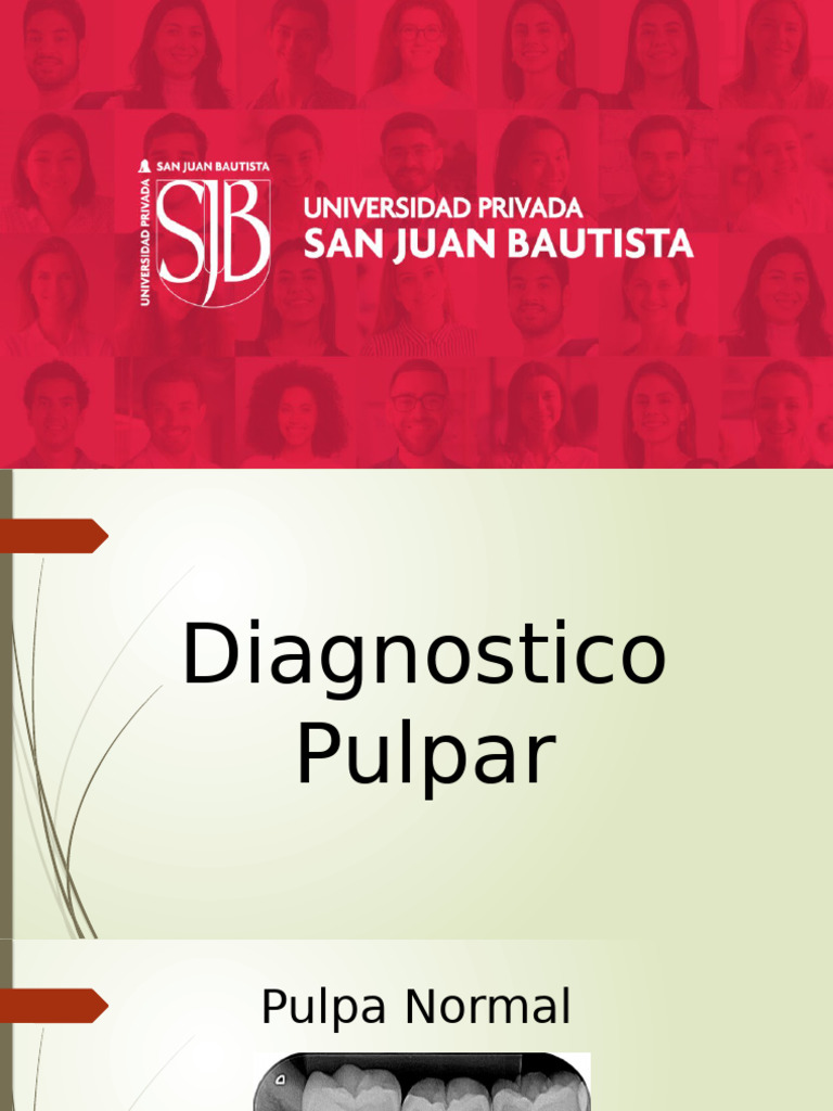 Exposicion de DX Pulpar | PDF