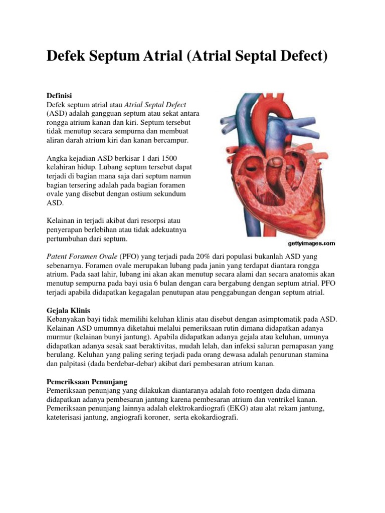 Defek Septum Atrial | PDF