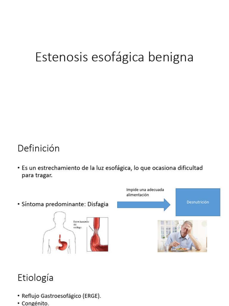 Estenosis Esofágica Benigna | PDF | La enfermedad por reflujo ...