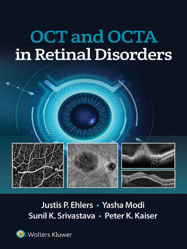 OCT and OCTA in Retinal Disorders | PDF