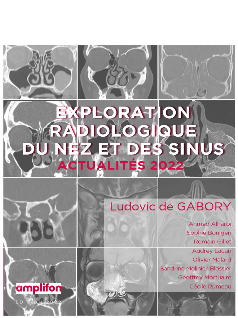 Monographie Amplifon Ndeg 72 | PDF