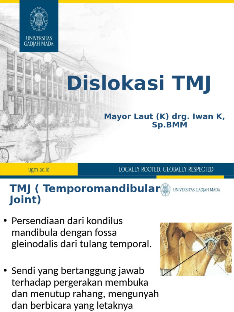 Dislokasi TMJ 1 | PDF