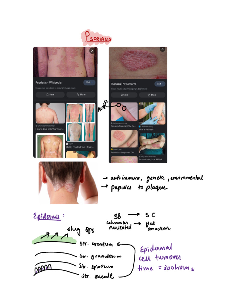 Psoriasis | PDF