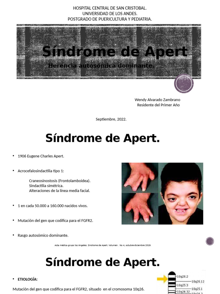 Síndrome de Apert y Crouzon Definitivo | PDF