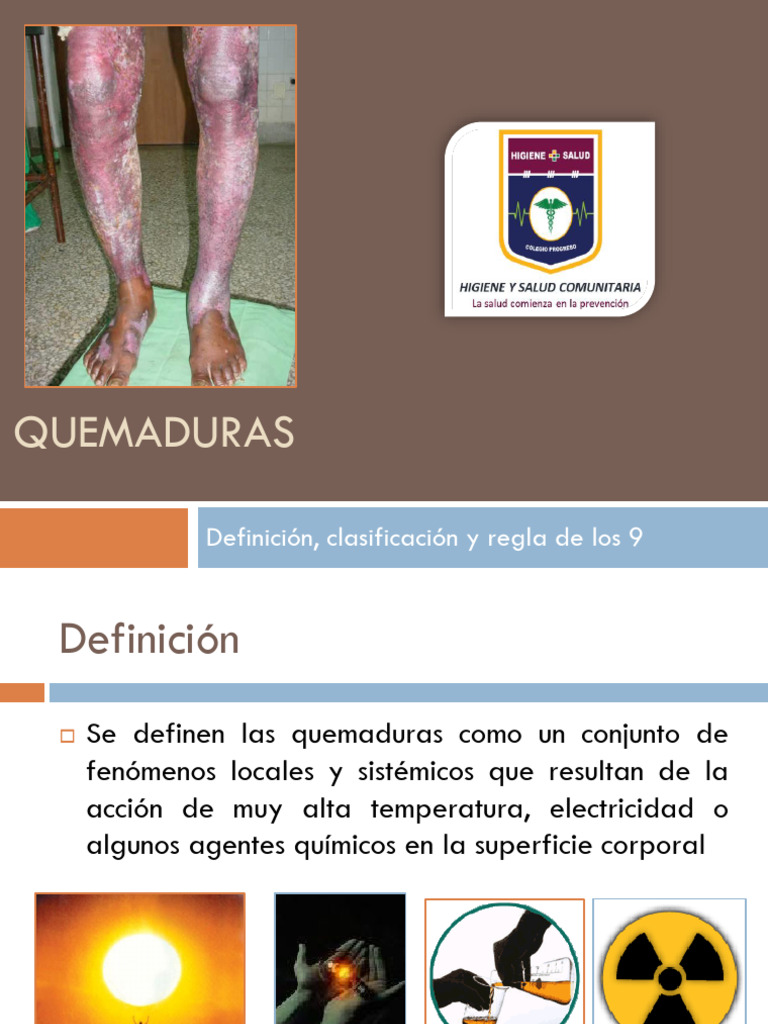 Prim Aux - Tema 2 - Quemaduras Etiologia y Regla de Los 9 2020 | PDF