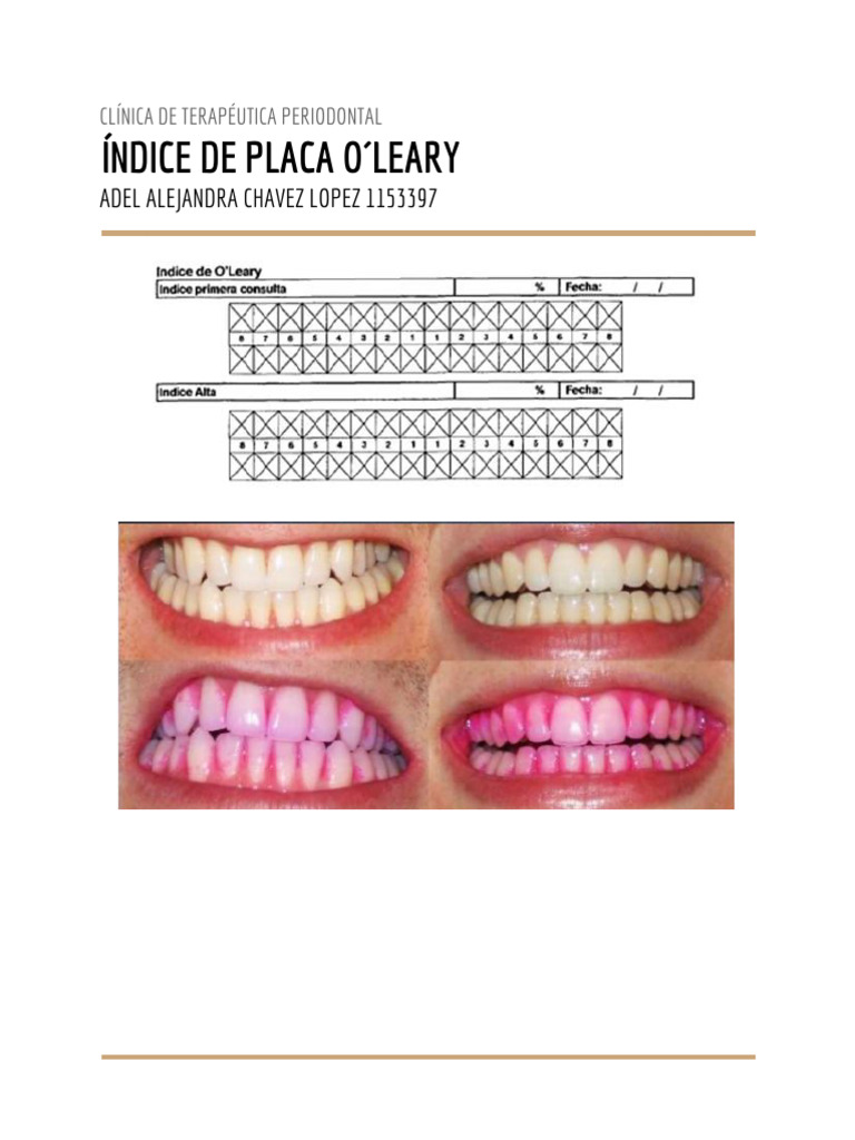 Indice de placa O´Leary | PDF
