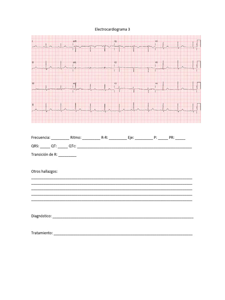 Electrocardiograma 3 | PDF