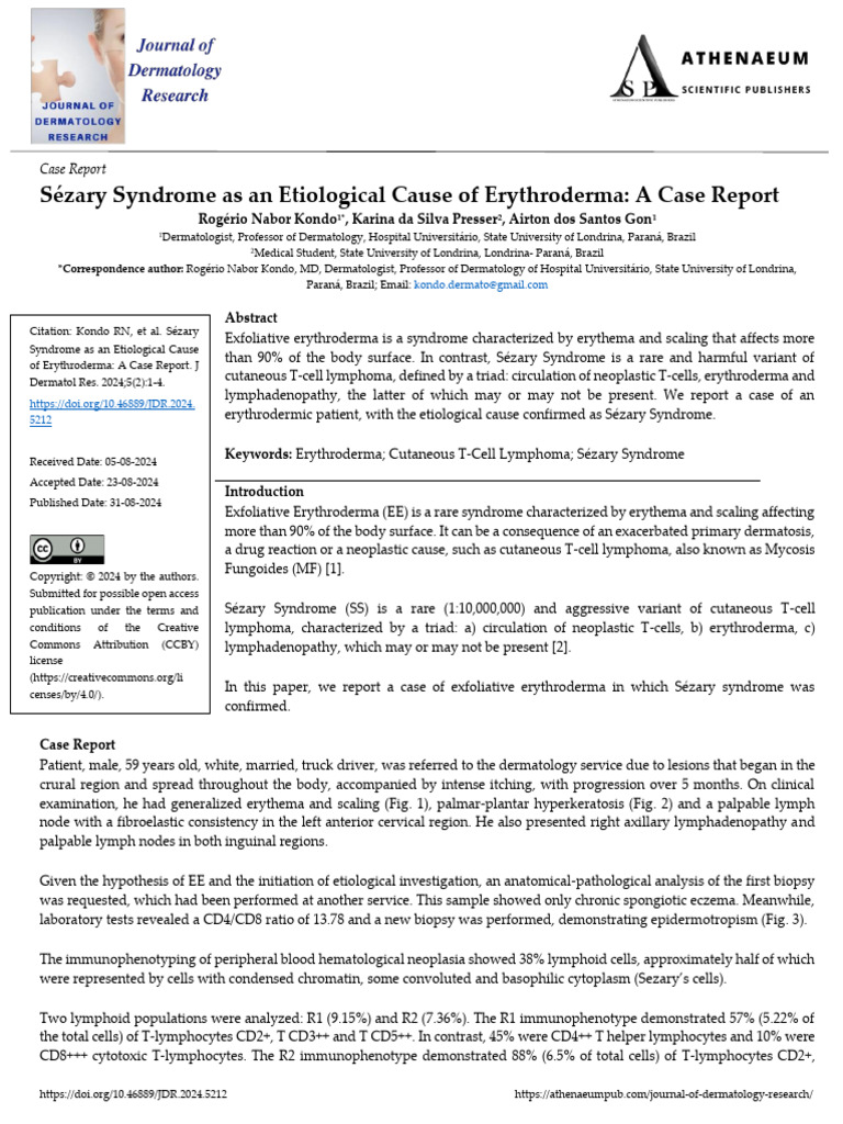 Sezary Syndrome As An Etiological Cause of Erythroderma A Case Report ...