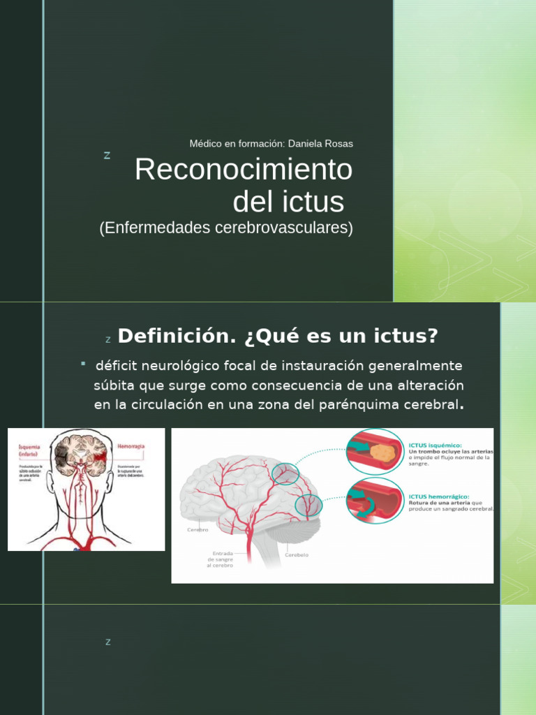 Final Reconocimiento Del Ictus | PDF
