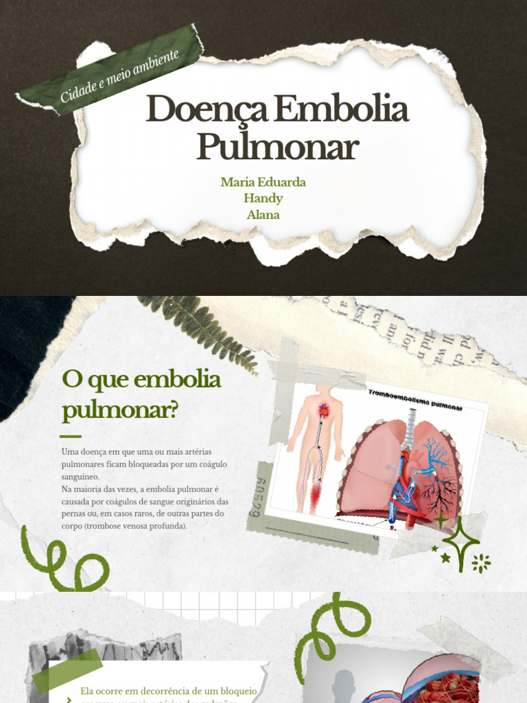 Doença Embolia Pulmonar | PDF