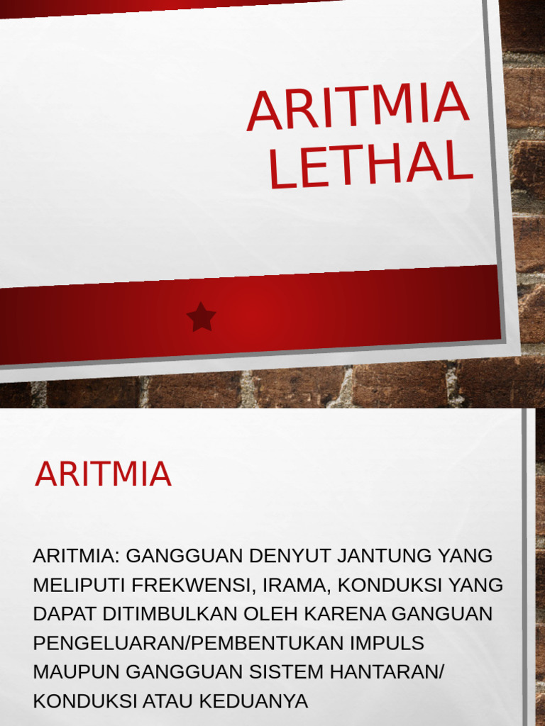 Aritmia Lethal | PDF