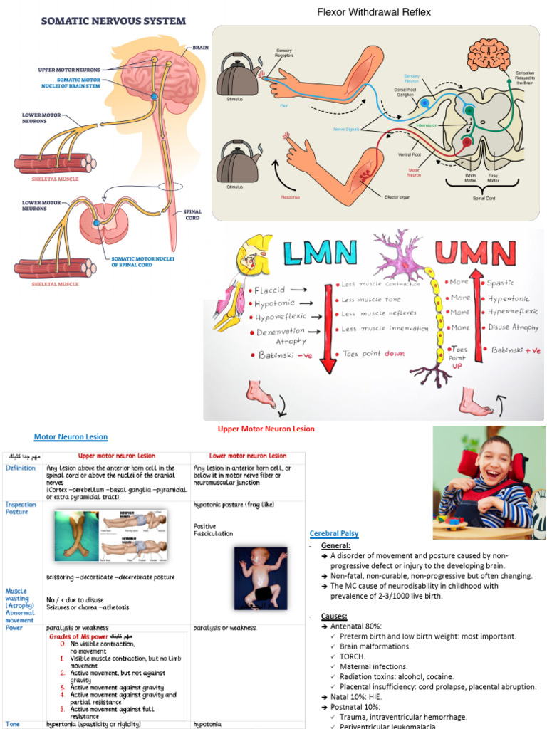 5. Upper Motor Neuron Lesion | PDF