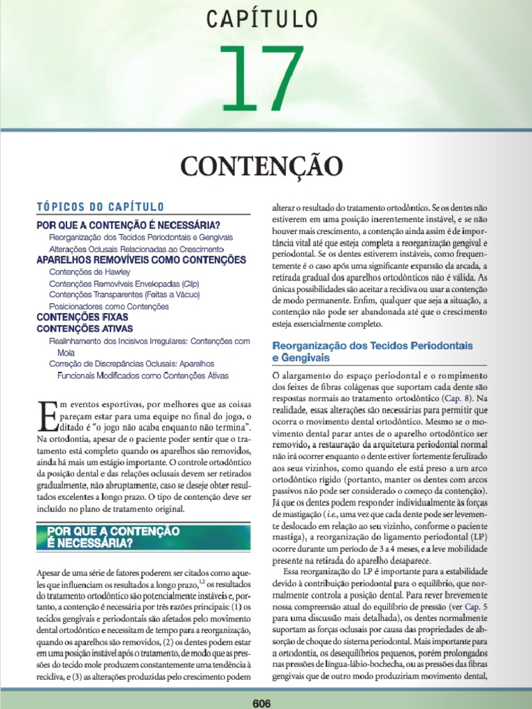 16 Proffit Cap 17 - Contenção | PDF
