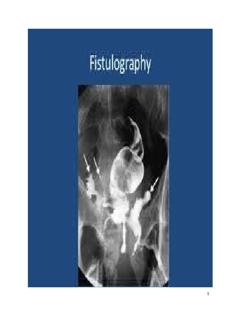 Fistulography NEW - 2 | PDF