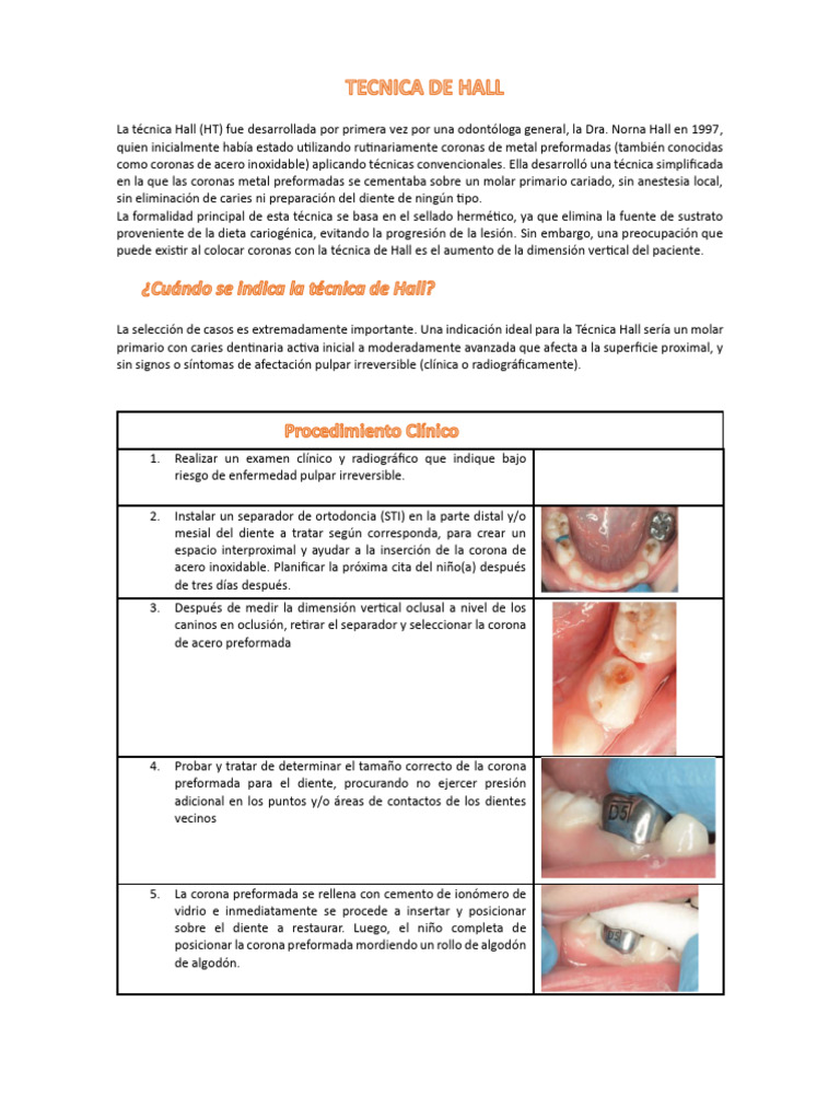 Tecnica de Hall | PDF