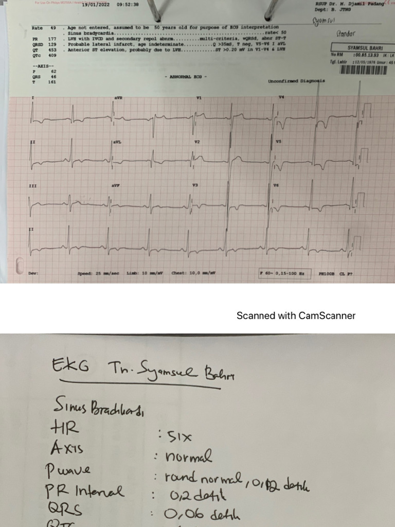 Belajar Ekg | PDF