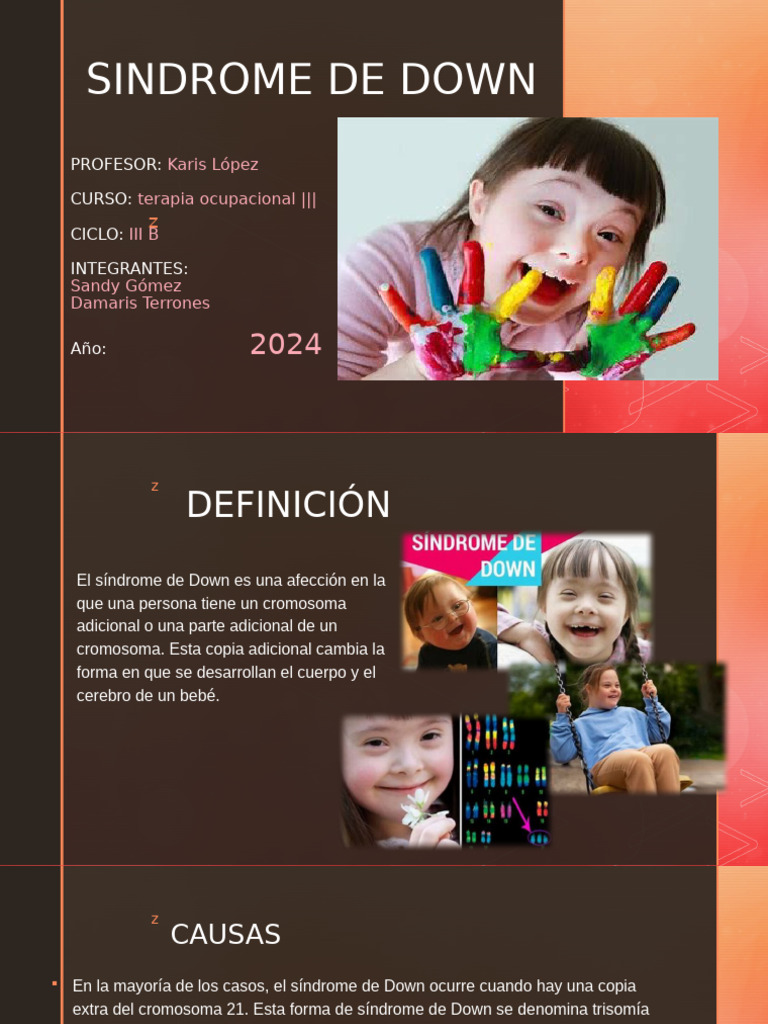 Sindrome de Dwon | PDF