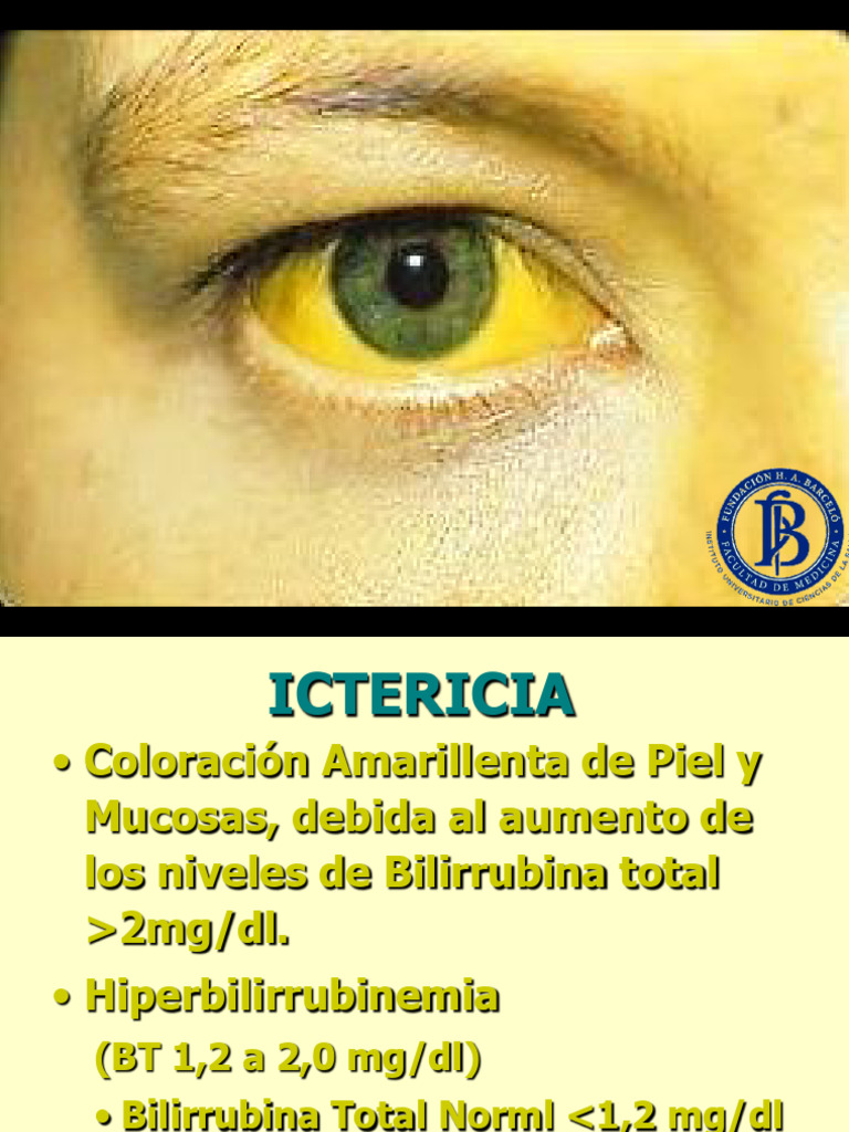 Ictericia | PDF