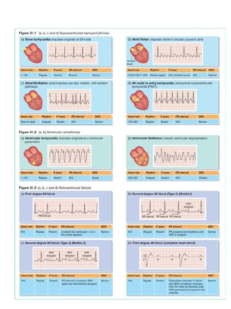 EKG Chart | PDF