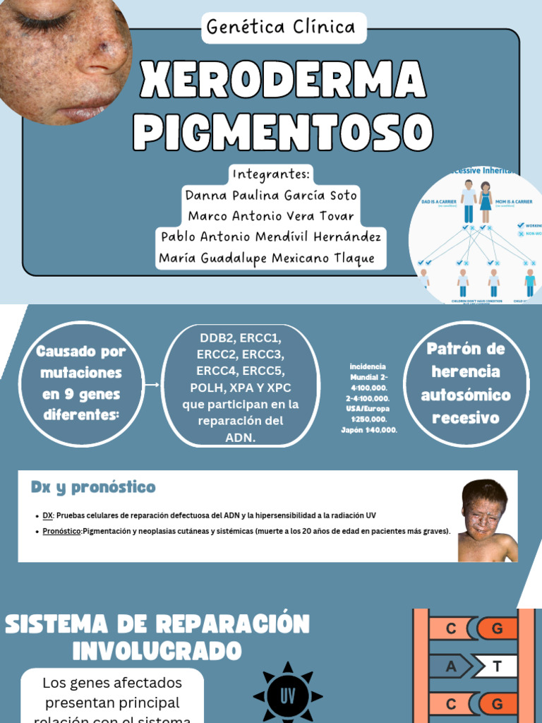 Xeroderma Pigmentoso | PDF