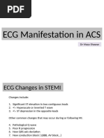 STEMI 12 Lead ECG Analysis Guide | PDF | Electrocardiography | Visual ...