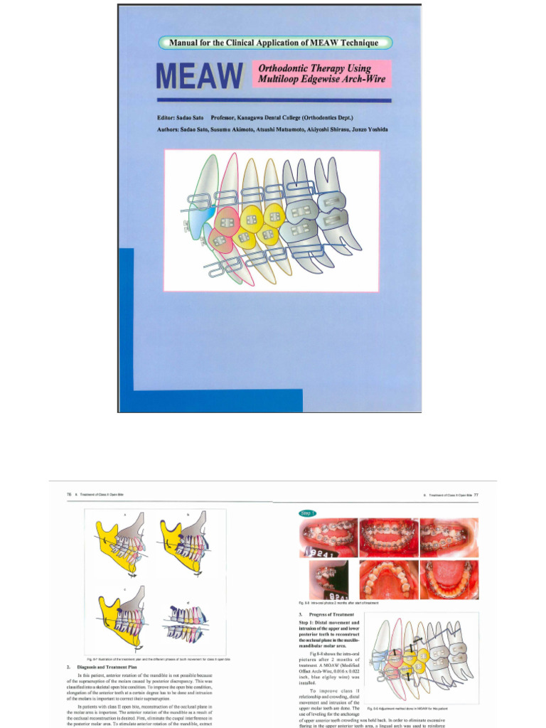 Clase 2 1 Meaw | PDF